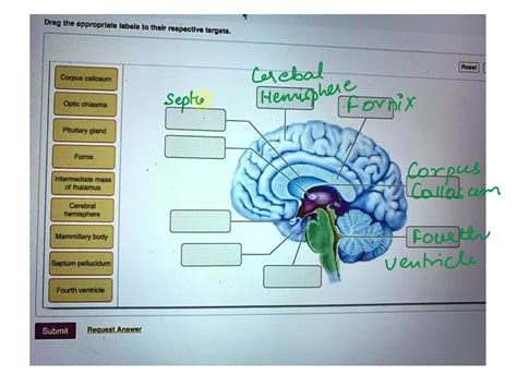 Solved Drag The Appropriate Labels To Their Respective Targets Fourth Ventricle Optic Chiasm