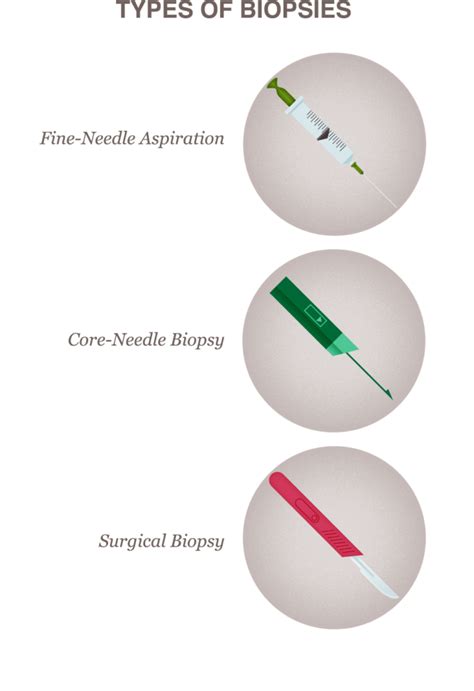 Fine Needle Biopsy Breast Atelier Yuwaciaojp
