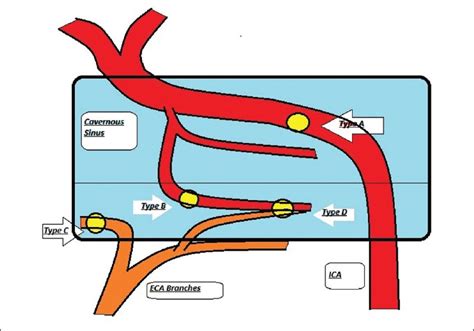 Stroke Medicine For Stroke Physicians And Neurologists Stroke Medicine For Stroke Physicians And Neurologists