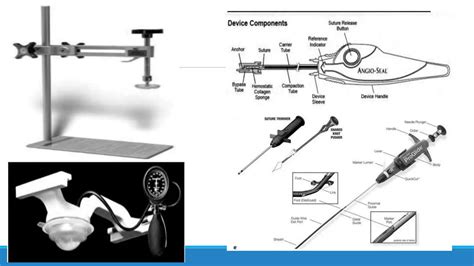 Diagnostic Procedure Of Dsa And Management Of Its Pptx