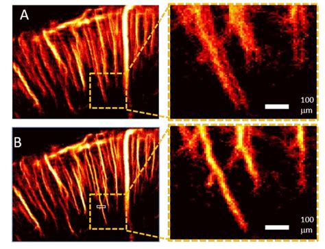 Translation Correction In The Rats Brain A Ulm Without Correction B Download Scientific