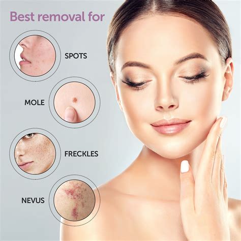 Removing Moles With Laser Sander