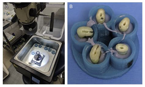 Microcomputed Tomographic Evaluation Of The Shaping Ability Of Waveone Gold Trushape Edgecoil