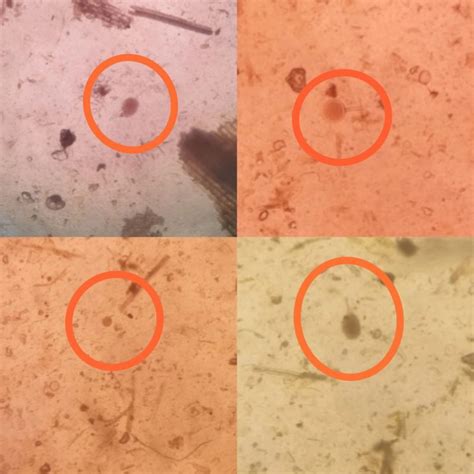 Maria Rajput On Linkedin Fasciola Hepatica Cercaria Under Microscope 🔬