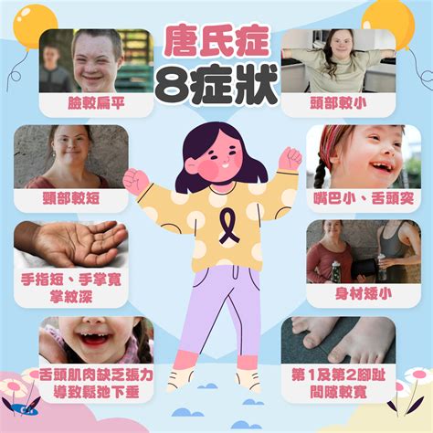 唐氏症為基因遺傳疾病 超過45歲的產婦生下唐寶寶的機率1 25！ 中天新聞網