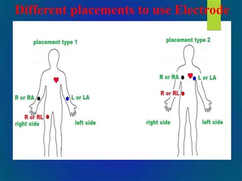 Real Time Monitoring Of Elctro Cardic Signals Using Arduino Ppt