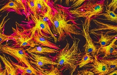 Collection Protocol Of Fetal And Foreskin Derived Fibroblasts Creative Bioarray Creative