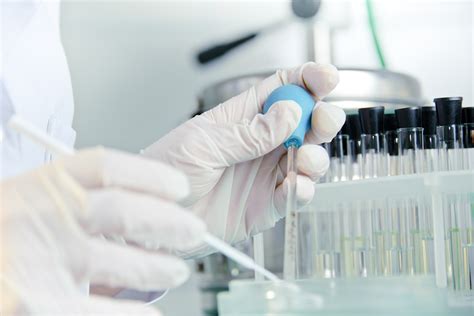 Antibody Arrays And Cytokine Arrays For Protein Profiling Proteomic