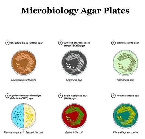 Medical 🔬 Microbiology Agar Plates Identifying Pathogens With Precision 🦠