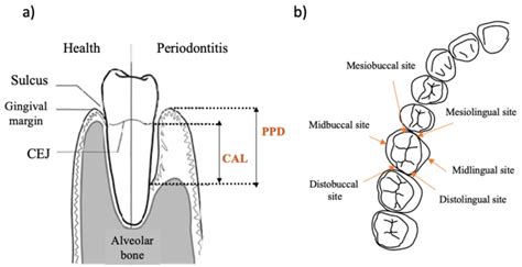illustrations of periodontal measurements a periodontal probing depth