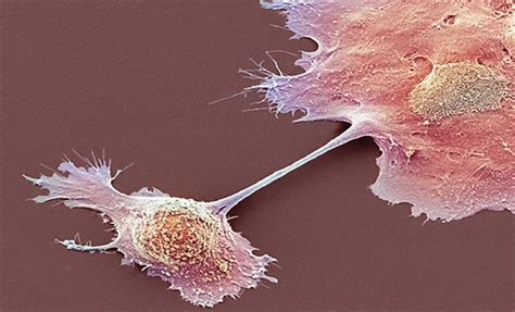 Chek2 Gene Mutations Predispose To Papillary Thyroid Cancer Cancer Therapy Advisor