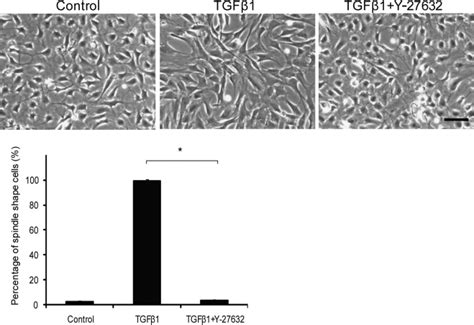 the effect of y 27632 on keratocyte morphology the percentage of
