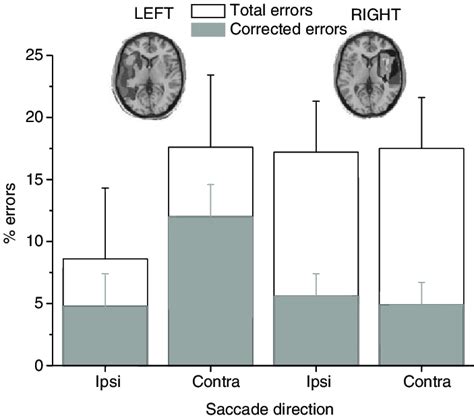 Relative Direction Of Corrected And Uncorrected Saccade Errors In The Download Scientific