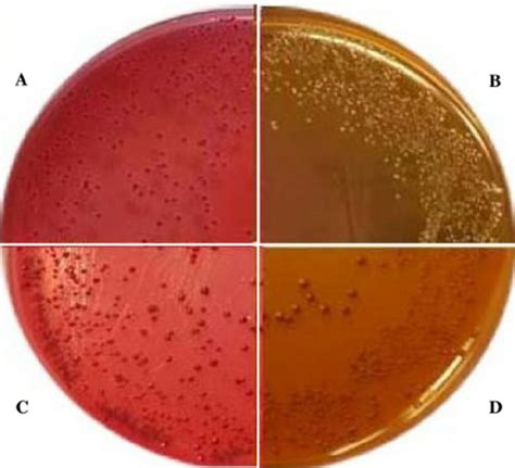 Enterococcus Faecalis Macconkey Agar