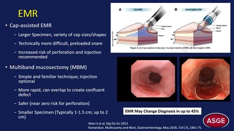 American Society For Gastrointestinal Endoscopy Asge On Linkedin