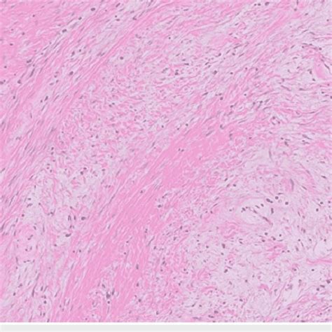 Photomicrograph Of Hande Stained Tissue Section At 100x Original