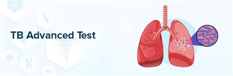 Understand Why You Need Advanced Testing Methods In Tb Get Better Understand Why You Need Advanced Testing Methods In Tb Get Better