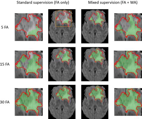 Comparison Of Our Approach With The Standard Supervised Learning For Download Scientific