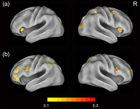The Effect Of Language Experience On Cross‐language Pattern Similarity Download Scientific