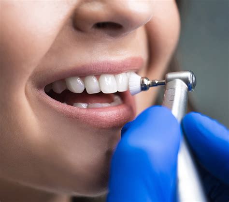 Professional Teeth Scaling And Polishing In Singapore Dental Cleaning