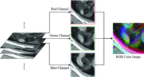 Process For Obtaining Serial Computed Tomography Ct Images With Red Download Scientific