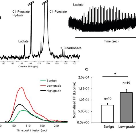 Hyperpolarized Hp 13 C Spectroscopy Of Tscs A Representative Download Scientific Diagram