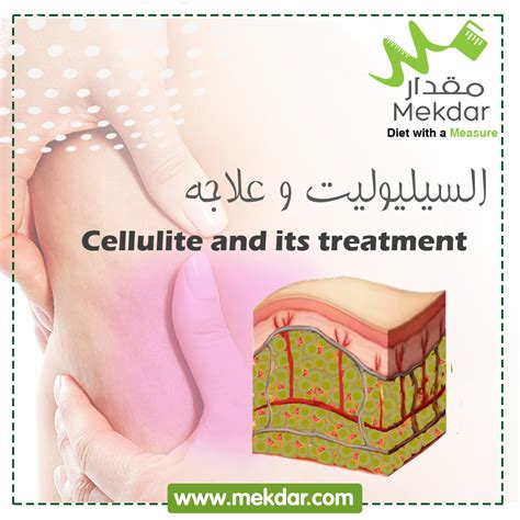 ما هو السيلوليت؟ الأسباب والعلاجات والوقاية مقدار Understanding