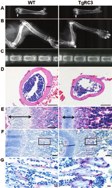 Tgrc Mice Are Osteoporotic With Increased Numbers Of Osteoclasts Ac Download Scientific