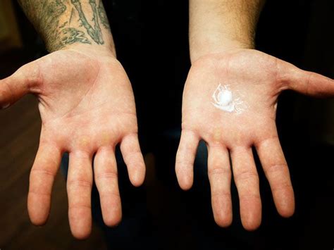 Germs On Hands Under Microscope