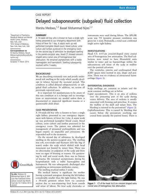 Pdf Delayed Subaponeurotic Subgaleal Fluid Collection