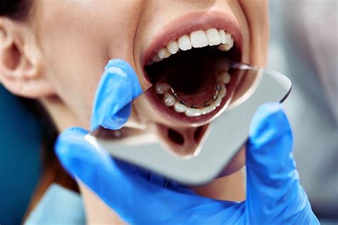 Adult Orthodontic Relapse When Surgery Helps