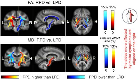 Comparison Of Fractional Anisotropy Fa And Mean Diffusivity Md Download Scientific Diagram