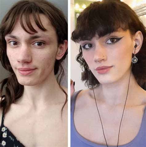 Made It To 1 Year Hrt 🏳️‍⚧️🤍 Rtrans