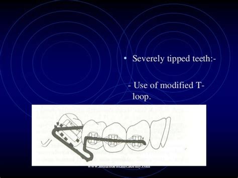 Adult Orthodontics 2