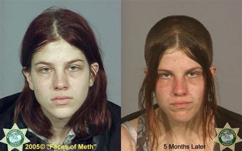 Meth Addicts Before And After 38 Pics