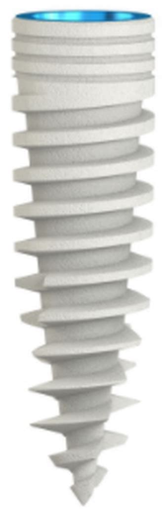 Cortex Dynamix Internal Hex Dental Implant Spotimplant