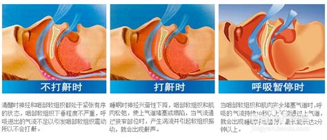 打鼾，打呼噜是怎么回事 百度经验