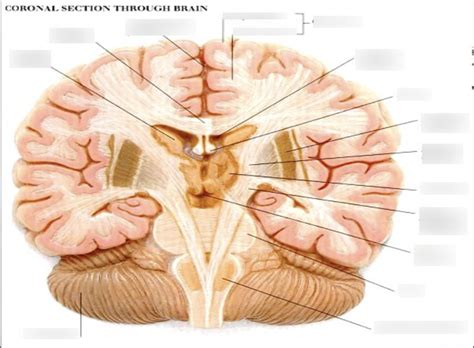 Anatomy Lab 1 Coronal Section Through Brain Diagram Quizlet