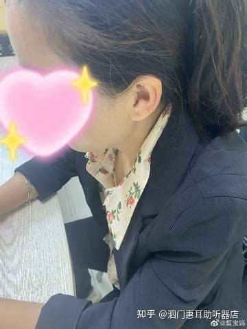 泗门惠耳助听器验配师工作日常取机篇 知乎