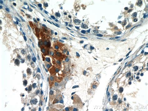 Lc3 Antibody 14600 1 Ap Proteintech 武汉三鹰生物技术有限公司