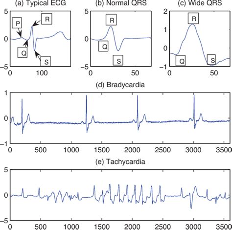 Scp Ecg Semantic Scholar
