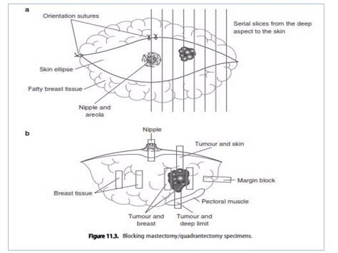 Histopathology Specimen Processing Pptx