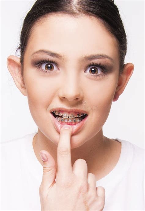 Beautiful Young Girl With Brace Stock Image Image Of Teenager Tasty