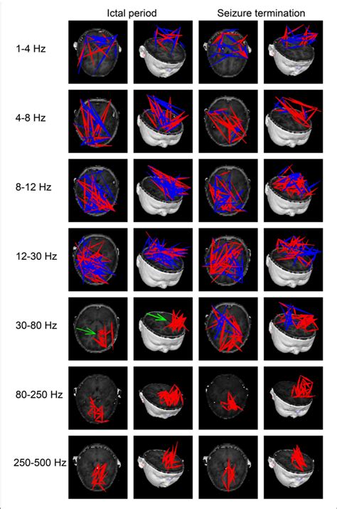 Typical Patterns Of Functional Connectivity Fc Networks From