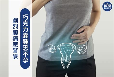 劇烈腹痛應警覺 巧克力囊腫恐不孕 Uho優活健康網