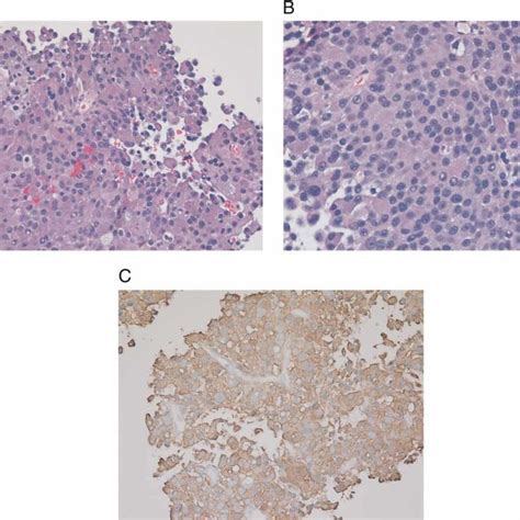 A Hematoxylin And Eosin Stained Histology Section Of The L3 Download Scientific Diagram