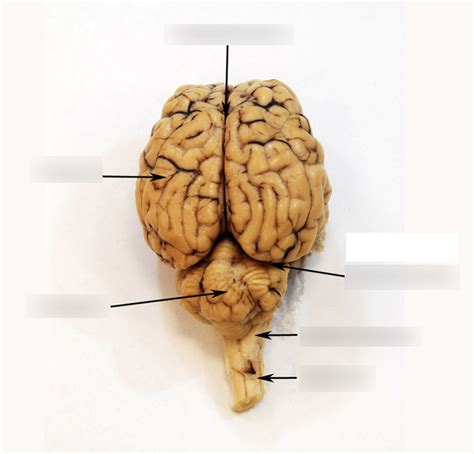 Sheep Brain Diagram Quizlet