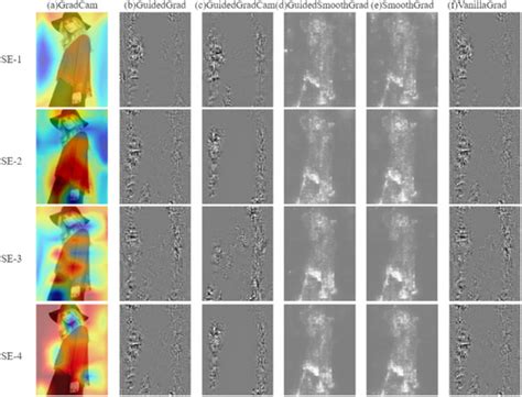 Se‐swin An Improved Swin‐transfomer Network Of Self‐ensemble Feature Extraction Framework For