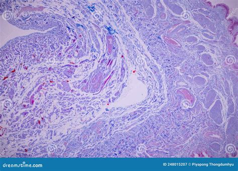 Columnar Epithelium Of Human Gall Bladder Under The Microscope In Lab Royalty Free Stock
