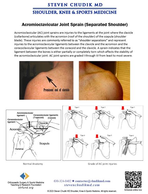 Acromioclavicular Joint Sprain Separated Shoulder Symptoms Treatment